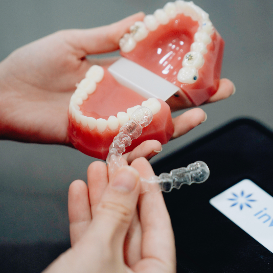 Ataches Invisalign Barcelona - Invisalign Barcelona